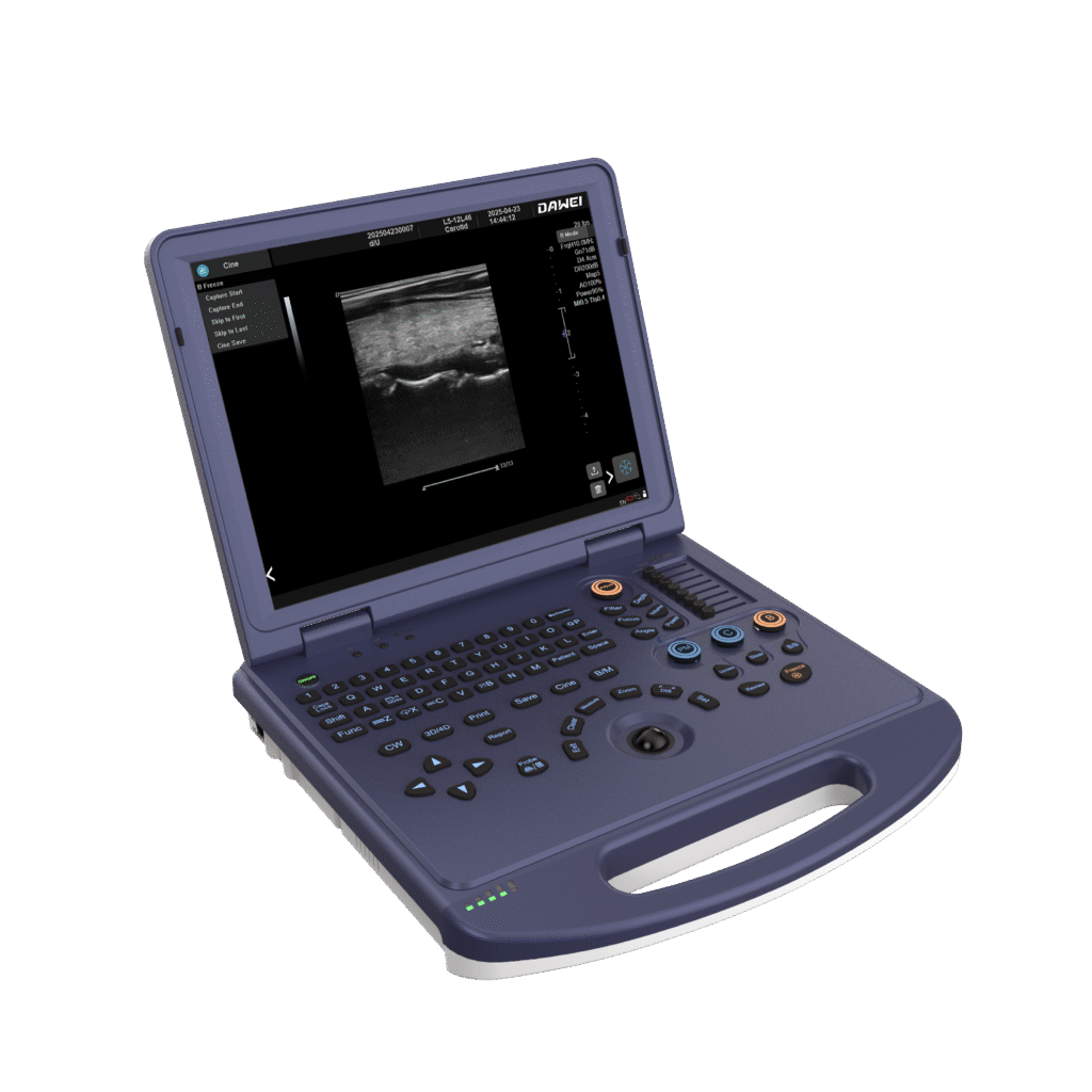 Dawei DW-L3i Laptop Diagnostic Ultrasound Machine
